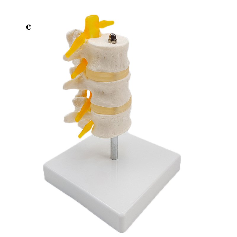 Human Anatomical Multi-section Lumbar Vertebral Spine Anatomy Skeleton ...