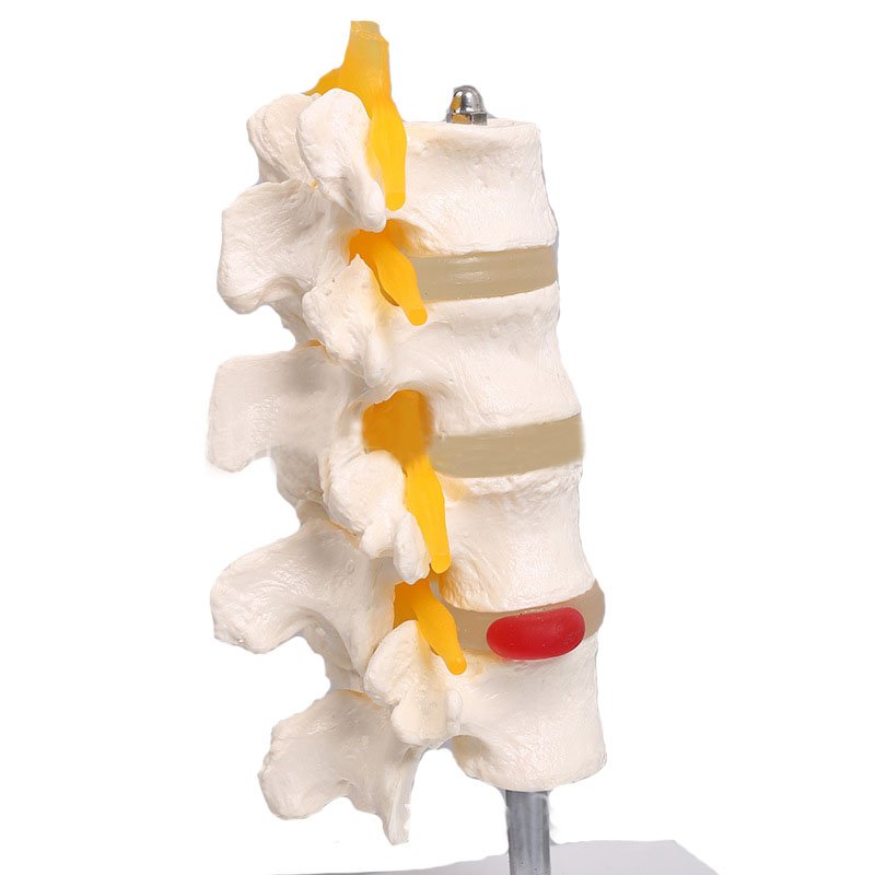 Human Anatomical Lumbar Vertebral Spine Anatomy Skeleton Model School ...